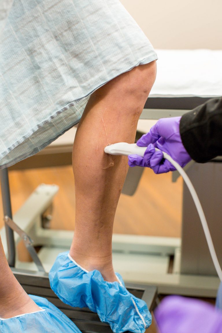 What You Can Do to Boost Your Vein Health - Charlotte Radiology