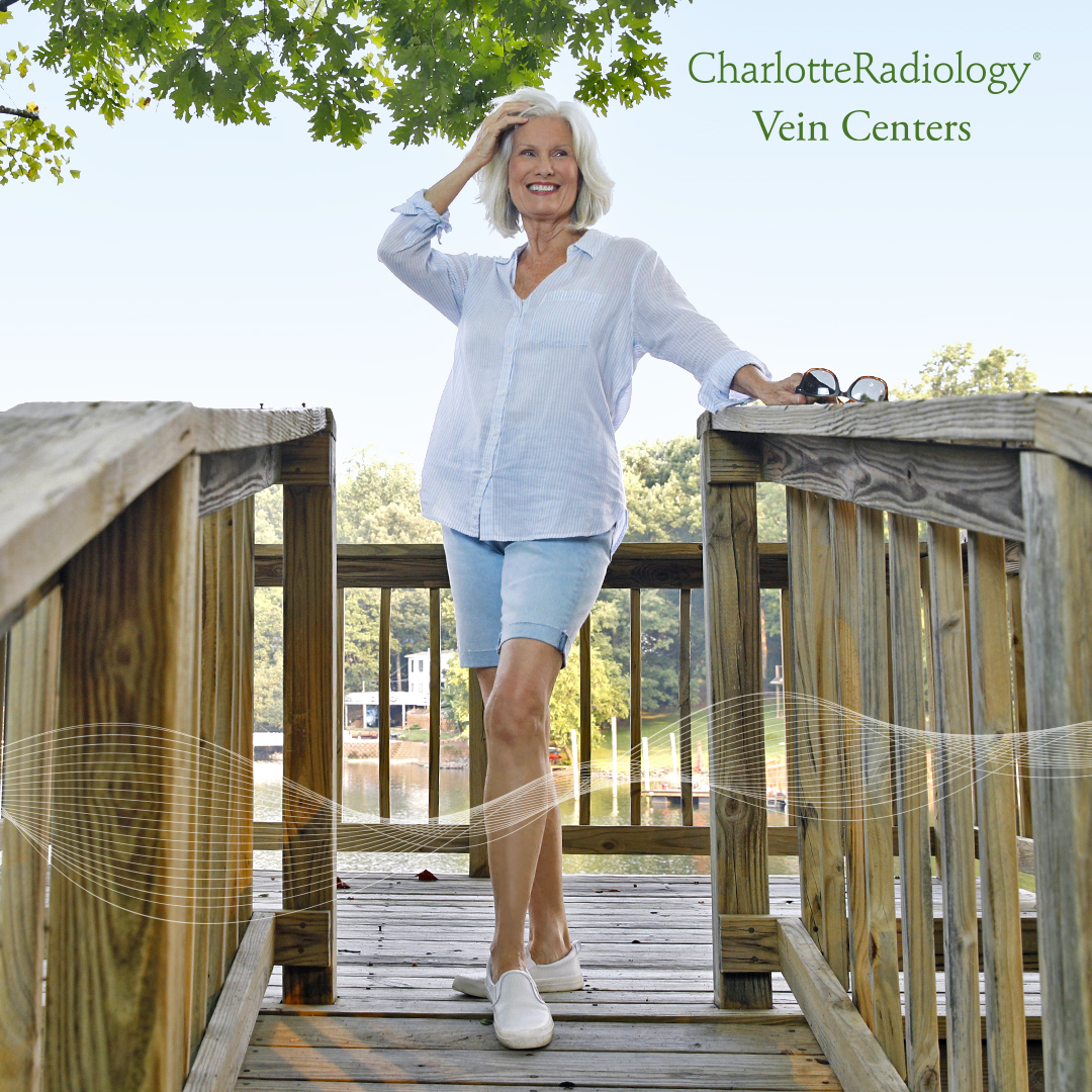 What You Can Do to Boost Your Vein Health - Charlotte Radiology