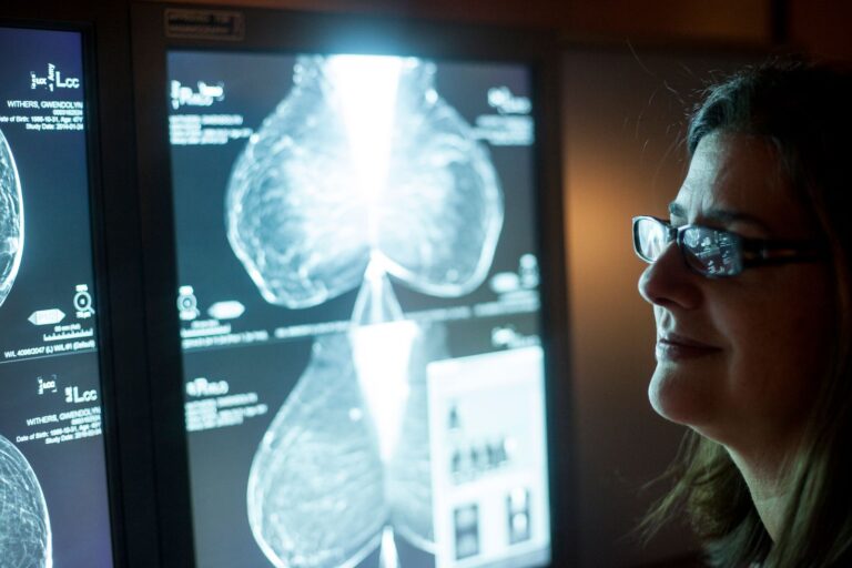 Your Best Mammogram Age: When to Start and Stop Screening Mammograms ...