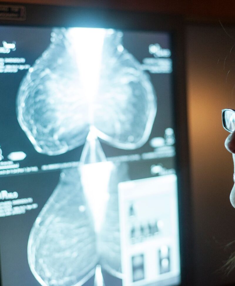 Blog - Charlotte Radiology